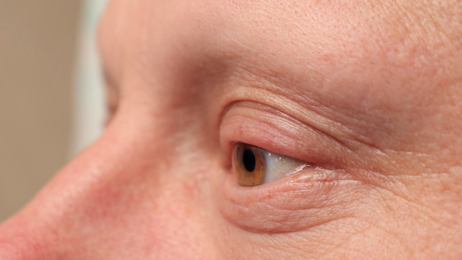 Cancer oculaire: quels sont les signes et les symptômes