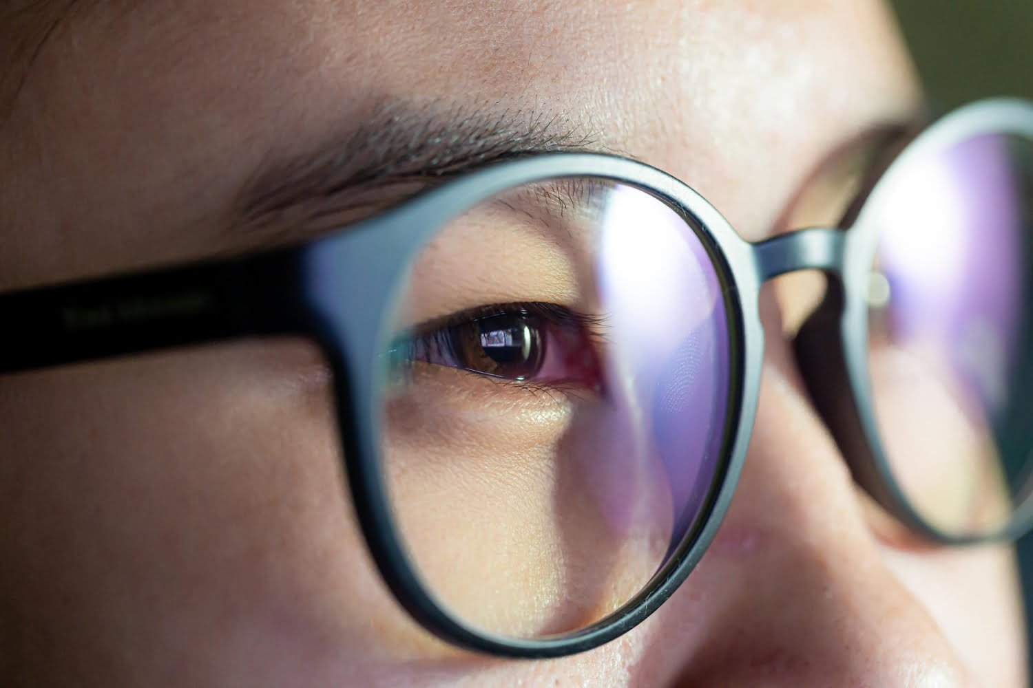 8 signes d'une mauvaise santé qui sont visible sur vos yeux